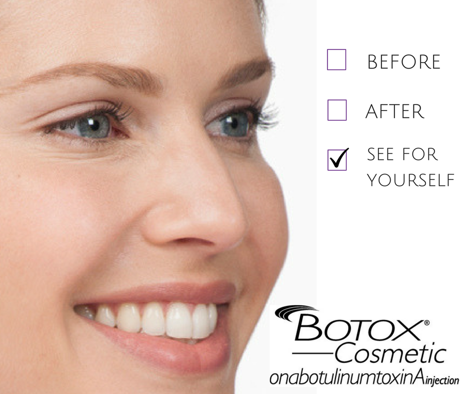 Fillers / Botox | Riemer Eye Center